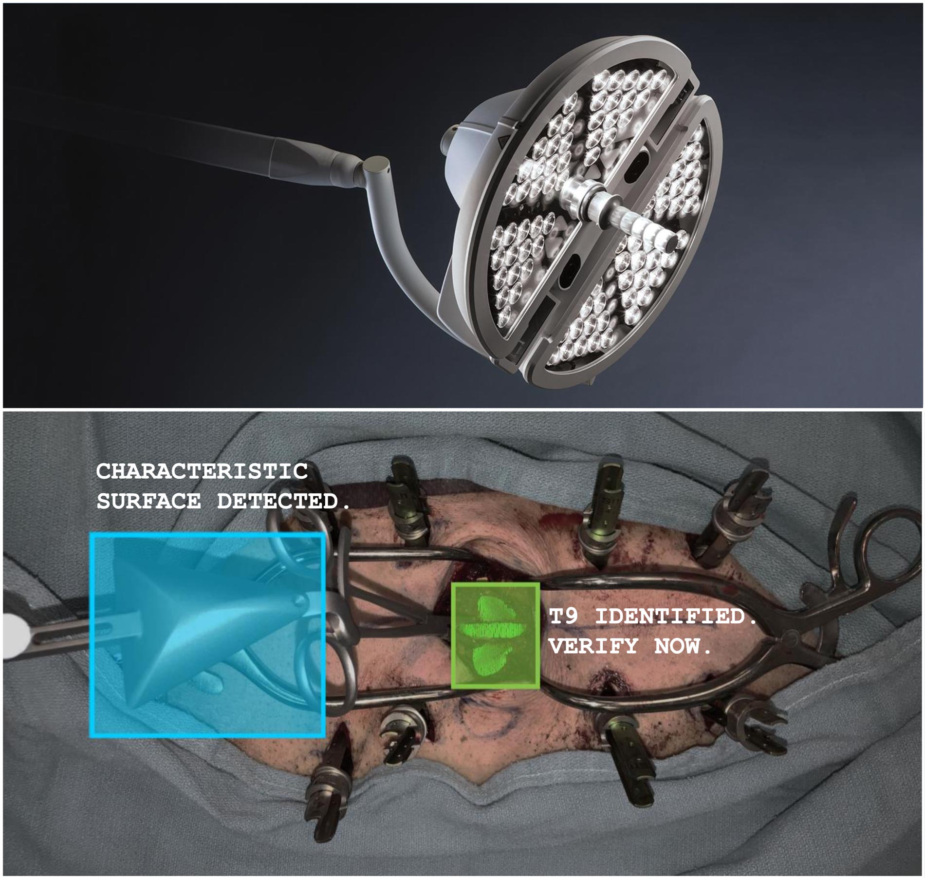 FLASH Navigation with 7D Technology - CDA Spine