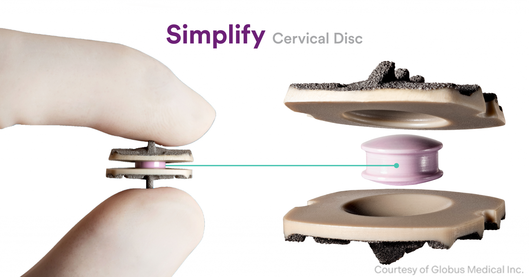 Cervical Artificial Disc Replacement - CDA Spine